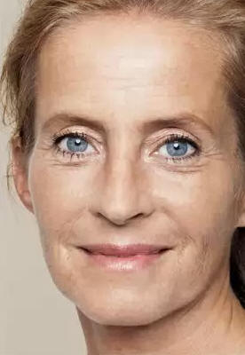 Wrinkle Smoothing Treatment – Weston Beauty Clinic