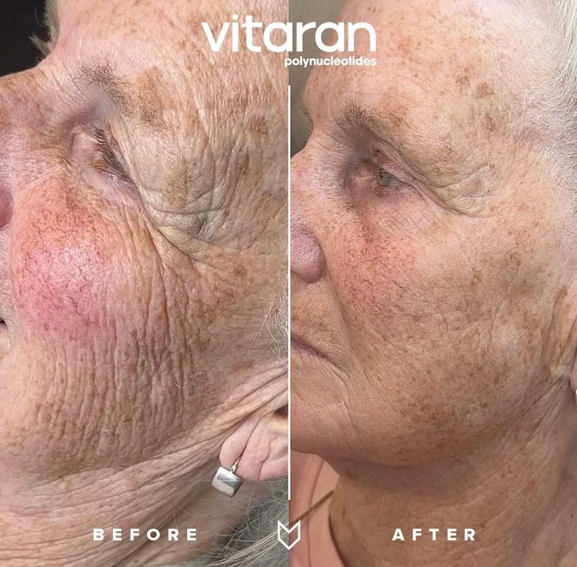 Polynucleotides – Weston Beauty Clinic